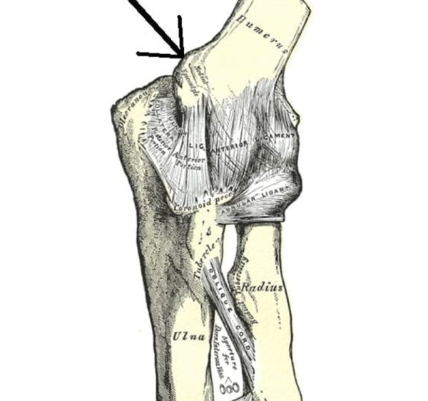 Golfer’s Elbow – The Upper Limb Clinic
